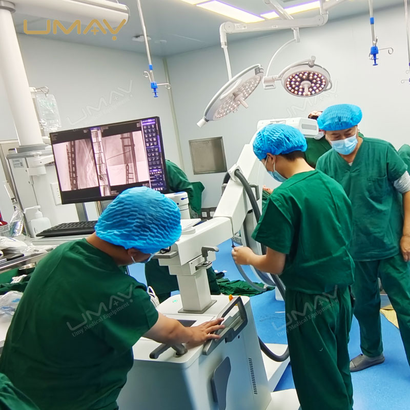 5kW Mobile C-Arm Fluoroscopy Machine for Angiography and Medical Imaging