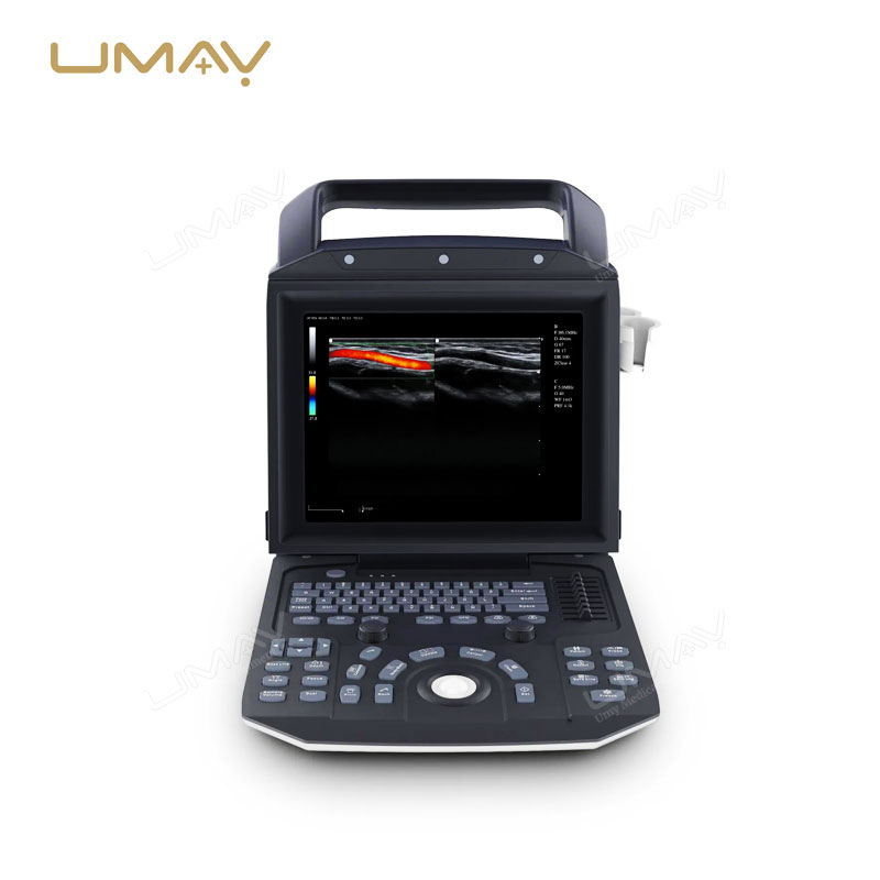 Portable Digital Color Doppler Ultrasound Machine for Human and ...