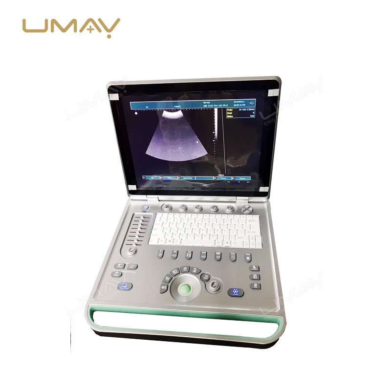 Full Digital Portable Laptop Ultrasound Instrument with Crystal-Clear ...
