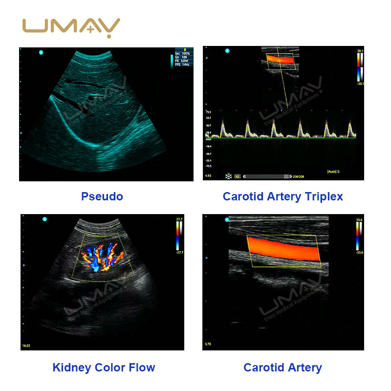 Portable 3D/4D Color Doppler Ultrasound Scanner for Obstetrics ...
