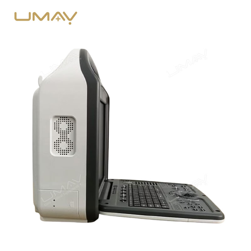 Portable Full Digital Color Doppler Ultrasound Diagnostic Instrument ...