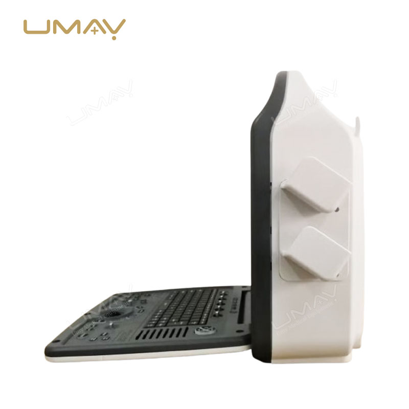 Portable Full Digital Color Doppler Ultrasound Diagnostic Instrument ...