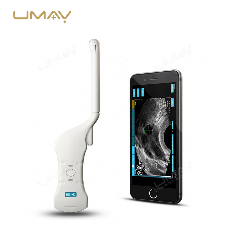 Portable Color Doppler Ultrasound Machine with 128 Elements and Convex and Transvaginal Probes