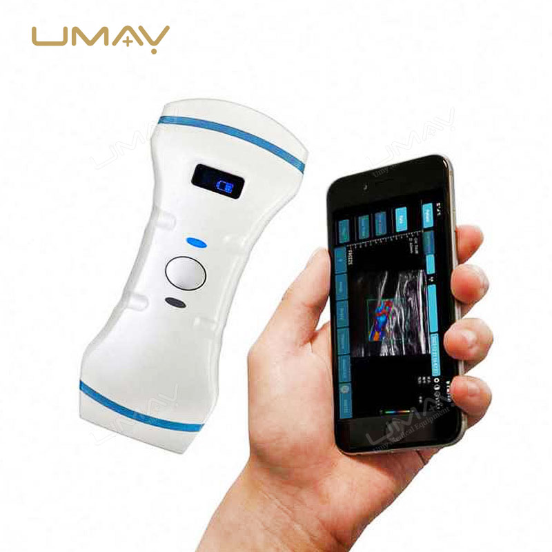 Wireless Color Doppler Ultrasound with AI Teaching for Emergency and Small Venue Applications