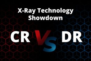 X-Ray Technology Showdown - CR vs DR Explained