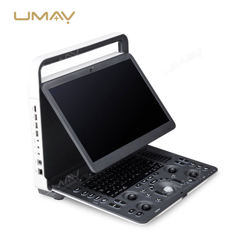 Portable E1 Ultrasound Machine Ideal for Abdominal, Obstetrics, and ...