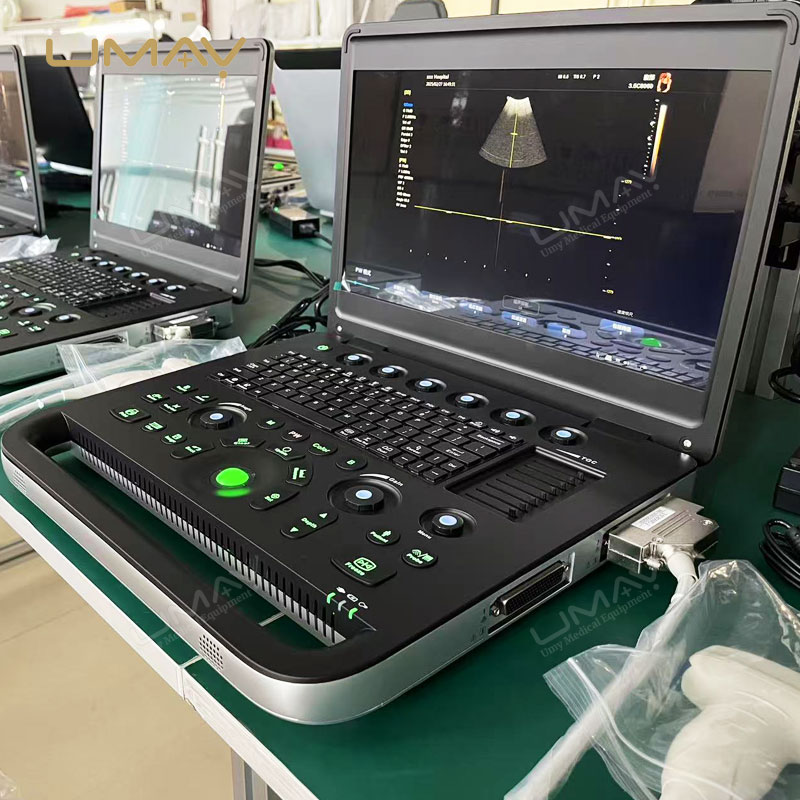 Ultra-thin B/W ultrasound machine with real-time spatial compound imaging