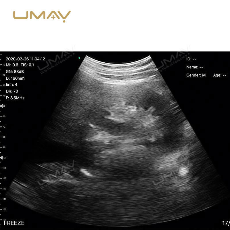Wireless Ultrasound Probe with 128 Elements and Convex Scanner for ...