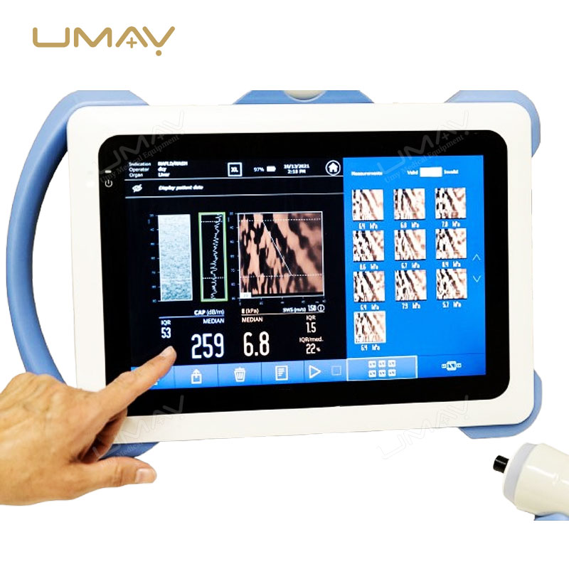 Non-Invasive Quantitative Liver Diagnostic Device for Reliable ...