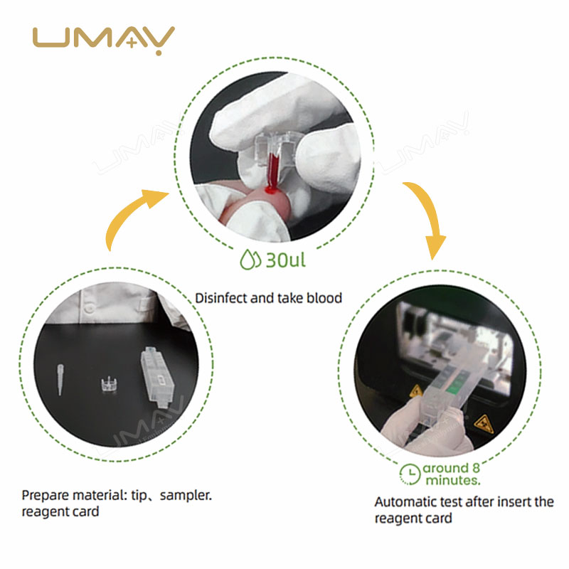 AI 5-Diff Morphological Analysis and Automatic Hematology Analyzer for ...
