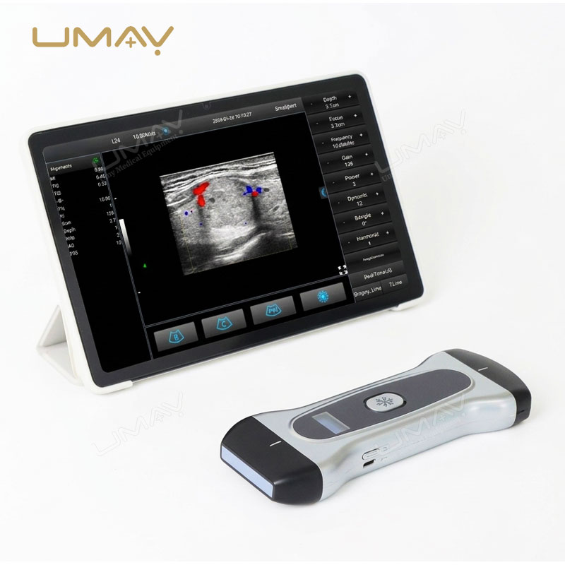 Wireless Pocket Ultrasound Probe With 3 in 1 Linear Convex and Phased ...